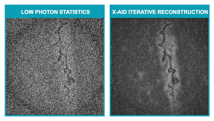Software X-AID — Iterative CT Reconstruction